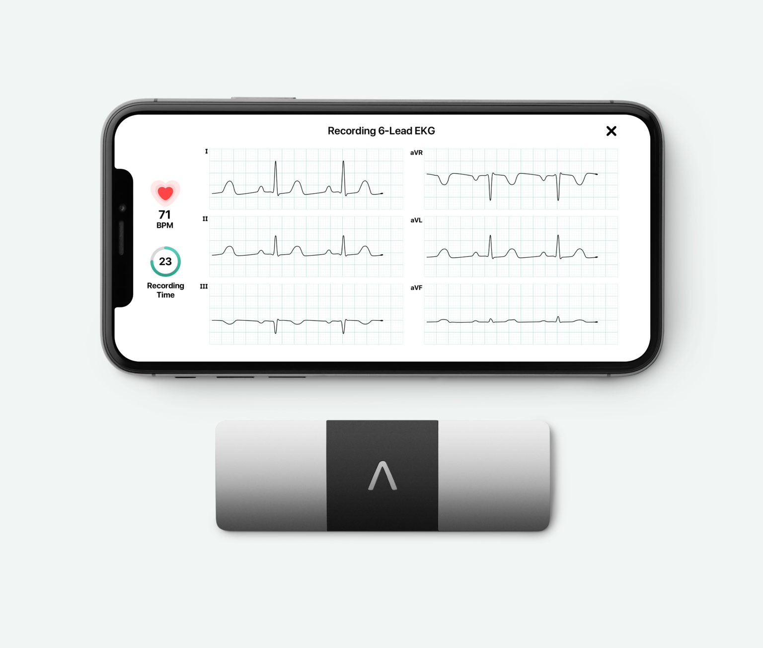 KARDIA MOBILE - kardia Medical