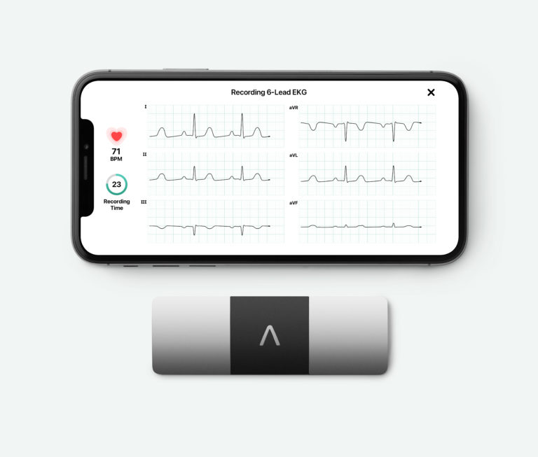 KARDIA MOBILE - kardia Medical